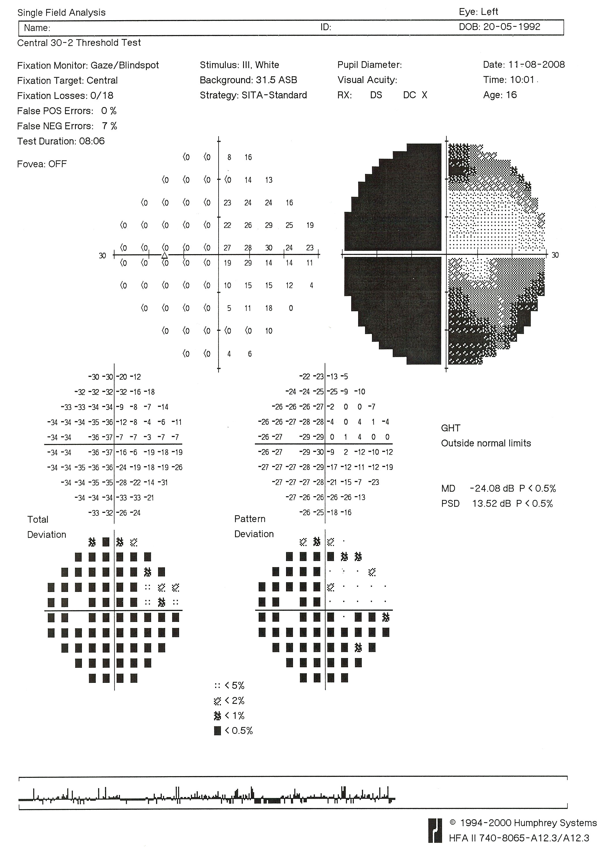 Automated Visual Fields | 9.12 | Westmead Eye Manual