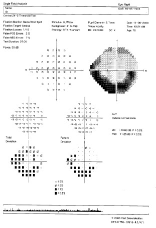 Automated Visual Fields | 9.12 | Westmead Eye Manual