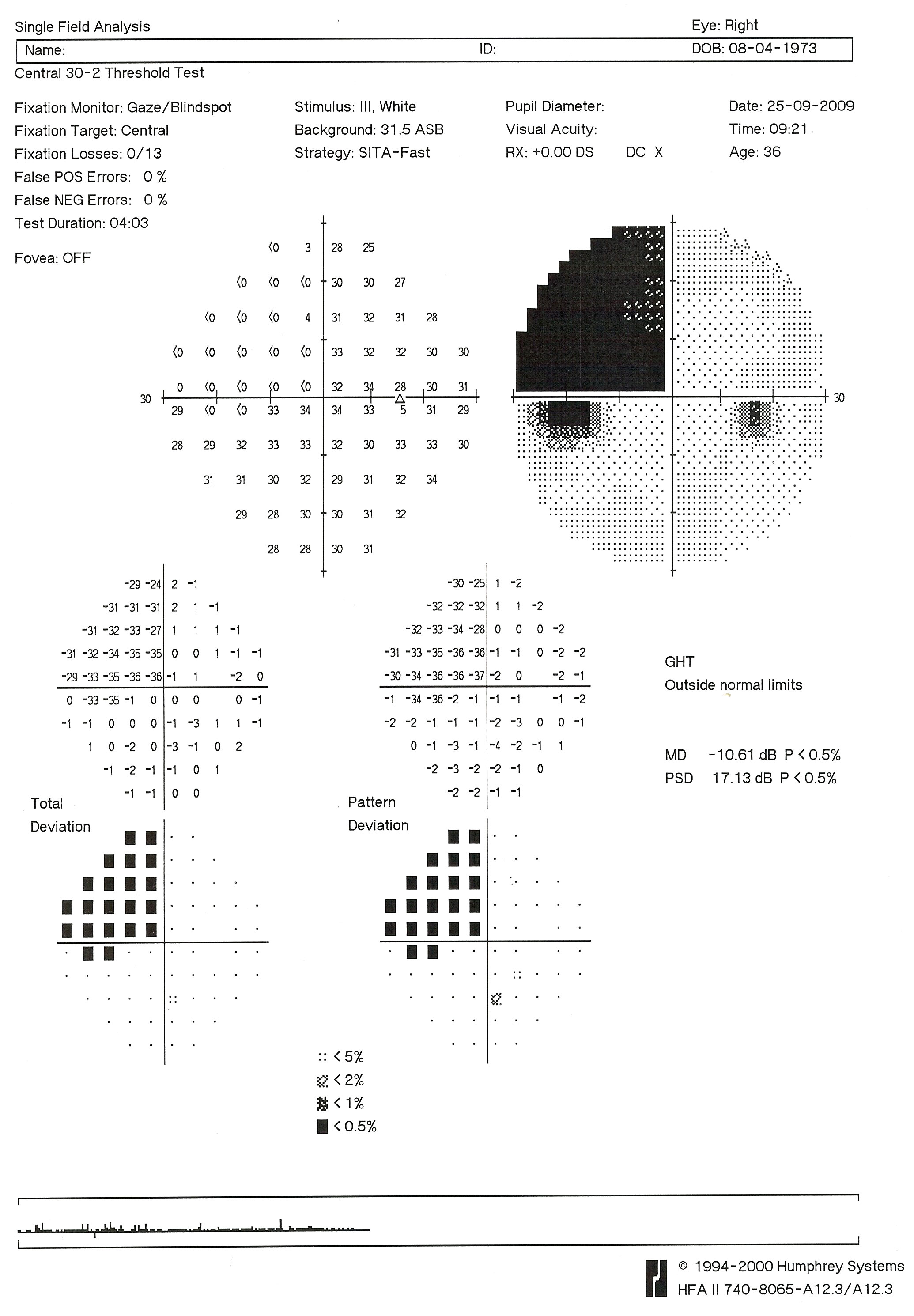 Automated Visual Fields | 9.12 | Westmead Eye Manual