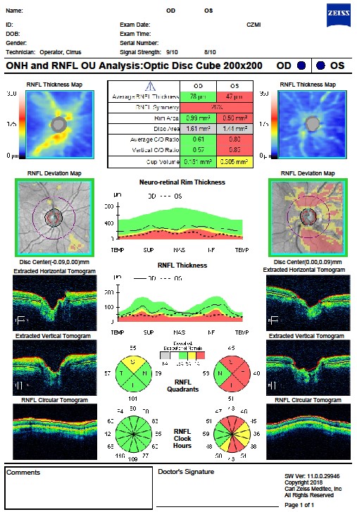 Optical Coherence Tomography - Glaucoma | 9.5 | Westmead Eye Manual
